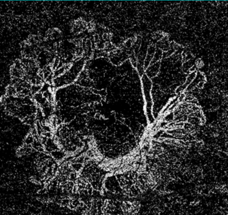 OCT-Angiographie - Centre Ophtalmologique Odéon